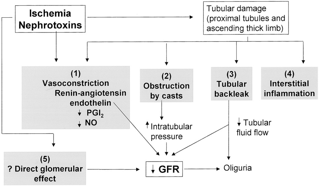 Acute Tubular Necrosis (ATN) - Stepwards