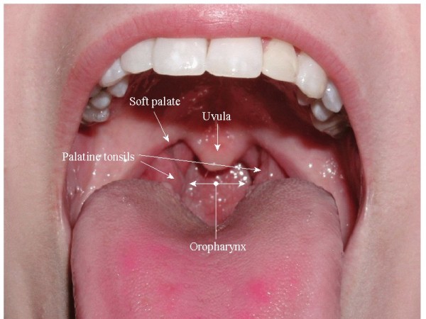 Head, Eyes, Ears, Nose, & Throat (HEENT) exam - Stepwards