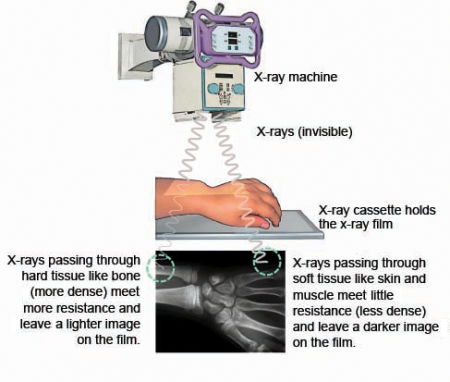 Fundamentals Of X-Ray Studies - Stepwards