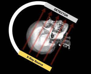 Commonly Utilized Angiographic Projections In Neurointerventional ...