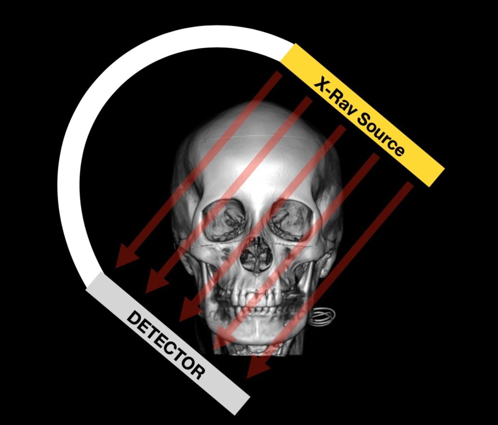Commonly Utilized Angiographic Projections In Neurointerventional ...